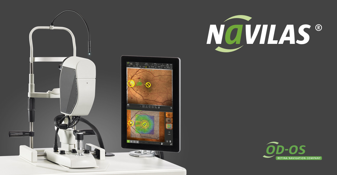 Studiengang: Navilas Laser System – die Verbindung zwischen Diagnostik ...